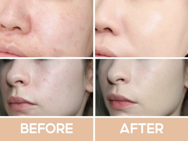 Kem nền Nars dành cho da gì? Review chi tiết và khách quan
